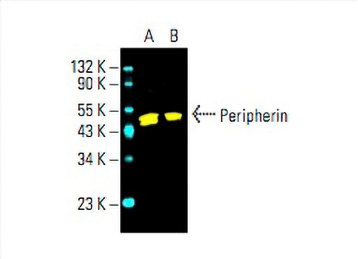 Anti-Peripherin Antibody (A-3) | SCBT - Santa Cruz Biotechnology
