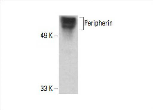 Anti-Peripherin Antibody (A-3) | SCBT - Santa Cruz Biotechnology
