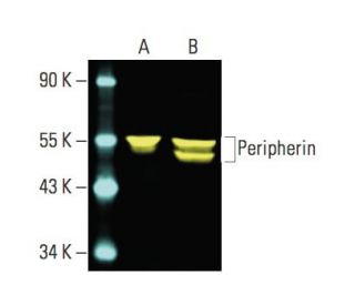 Anti-Peripherin Antibody (A-3) | SCBT - Santa Cruz Biotechnology