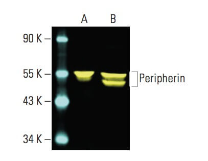 Anti-Peripherin Antibody (A-3) | SCBT - Santa Cruz Biotechnology