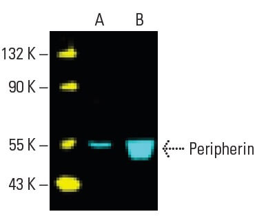 Anti-Peripherin Antibody (A-3) | SCBT - Santa Cruz Biotechnology