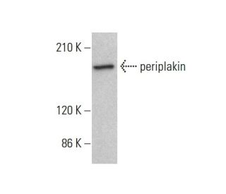 Anti-periplakin Antibody (AE11) | SCBT - Santa Cruz Biotechnology