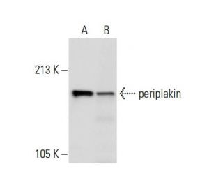 periplakin Antibody (G-1) - Western Blotting - Image 306258