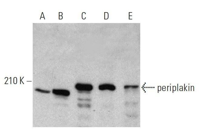 periplakin抗体 (G-1) | SCBT - Santa Cruz Biotechnology