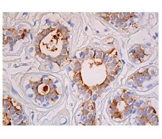 PERK Antibody (B-5) - Immunohistochemistry - Image 348802
