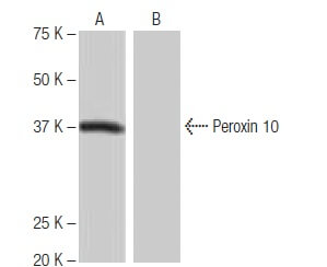 Anti-Peroxin 10 Antibody (Y-2D3) | SCBT - Santa Cruz Biotechnology