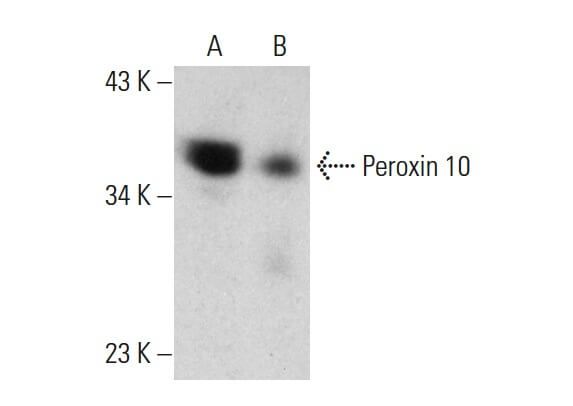 Peroxin 10 Antibody (Y-2D3) | SCBT - Santa Cruz Biotechnology