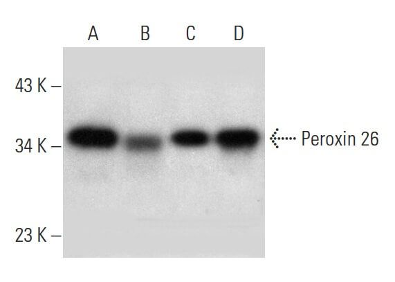 Peroxin 26 Antibody (F-7) | SCBT - Santa Cruz Biotechnology