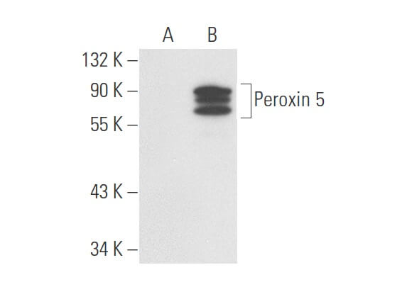 Peroxin 5 Antibody (B-3) | SCBT - Santa Cruz Biotechnology