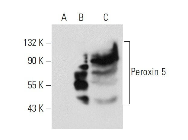 Anti-Peroxin 5 Antibody (B-3) | SCBT - Santa Cruz Biotechnology