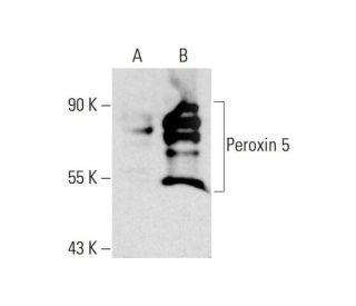 Peroxin 5 Antibody (B-3) | SCBT - Santa Cruz Biotechnology