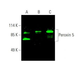 Peroxin 5 Antibody (B-3) | SCBT - Santa Cruz Biotechnology