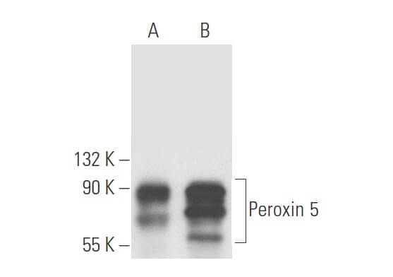 Peroxin 5 Antibody (F-9) | SCBT - Santa Cruz Biotechnology