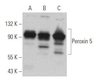 Peroxin 5 Antibody (F-9) | SCBT - Santa Cruz Biotechnology