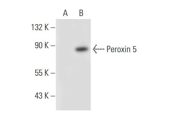 Peroxin 5R Antibody (A-4) | SCBT - Santa Cruz Biotechnology