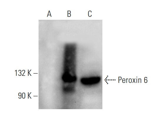 Peroxin 6 Antibody (F-6) | SCBT - Santa Cruz Biotechnology
