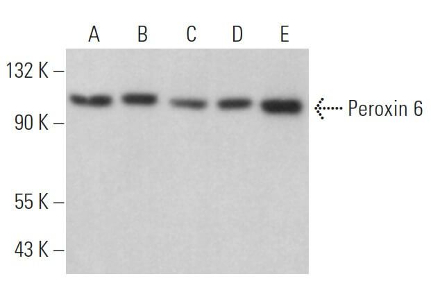Peroxin 6 Antibody (F-6) | SCBT - Santa Cruz Biotechnology