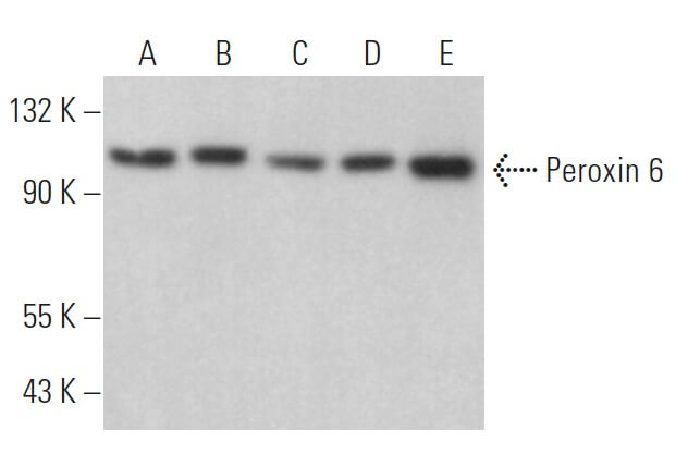 Peroxin 6 Antibody (F-6) | SCBT - Santa Cruz Biotechnology