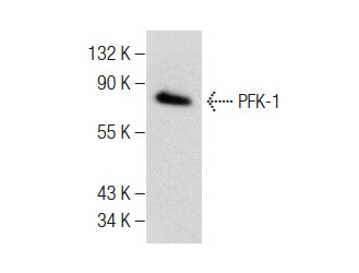 PFK-1 Antibody (E-4) | SCBT - Santa Cruz Biotechnology