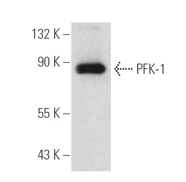 PFK-1 Antibody (E-4) | SCBT - Santa Cruz Biotechnology