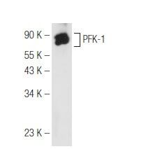PFK-1 Antibody (G-11) | SCBT - Santa Cruz Biotechnology