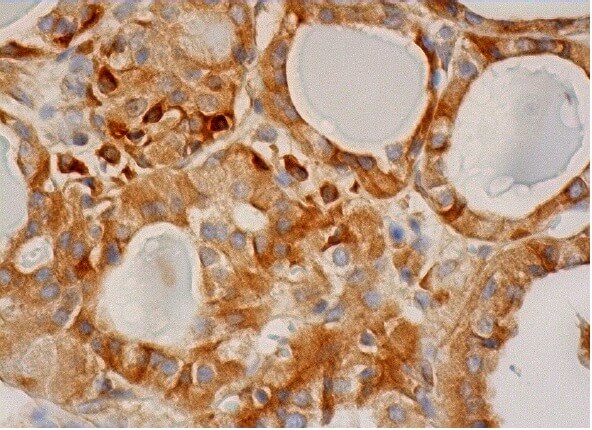 Anti-PGRMC2 Antibody (F-3) | SCBT - Santa Cruz Biotechnology