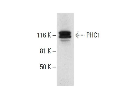 PHC1 Antibody (D-10) | SCBT - Santa Cruz Biotechnology