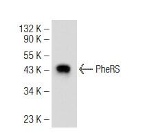 PheRS Antibody (F-9) | SCBT - Santa Cruz Biotechnology