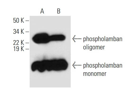 phospholamban Antibody (F-7) | SCBT - Santa Cruz Biotechnology