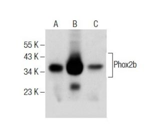 Phox2b Antibody (H-20) | SCBT - Santa Cruz Biotechnology