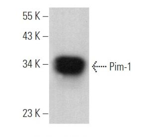 Pim-1 Antibody (12H8) - Western Blotting - Image 375154
