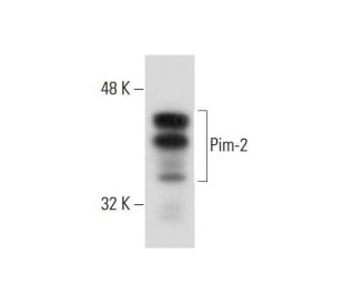 Anti-Pim-2 Antibody (1D12) | SCBT - Santa Cruz Biotechnology