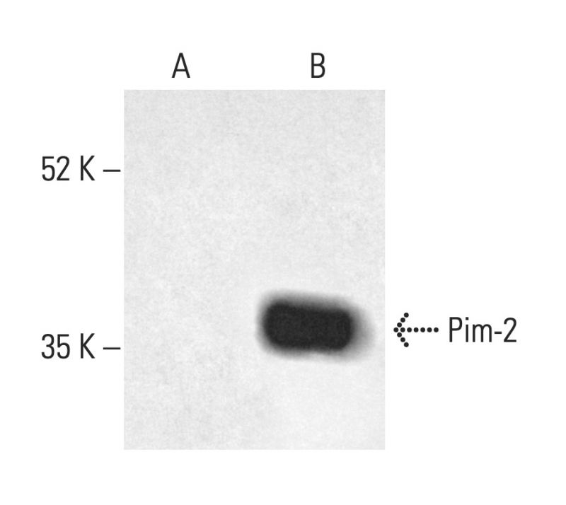 Pim-2 Antibody (1D12) | SCBT - Santa Cruz Biotechnology
