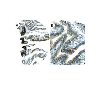 Pin1 Antibody (G-8) | SCBT - Santa Cruz Biotechnology