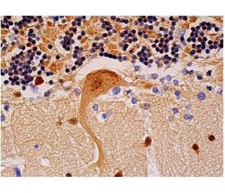 Pin1 Antibody (G-8) - Immunohistochemistry - Image 361386