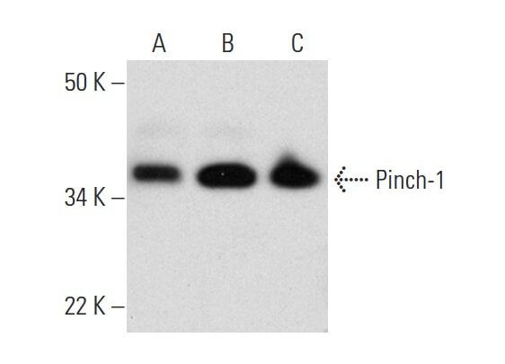 Pinch-1 Antibody (A-1) | SCBT - Santa Cruz Biotechnology