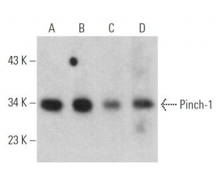 Anti-Pinch-1 Antibody (A-1) | SCBT - Santa Cruz Biotechnology