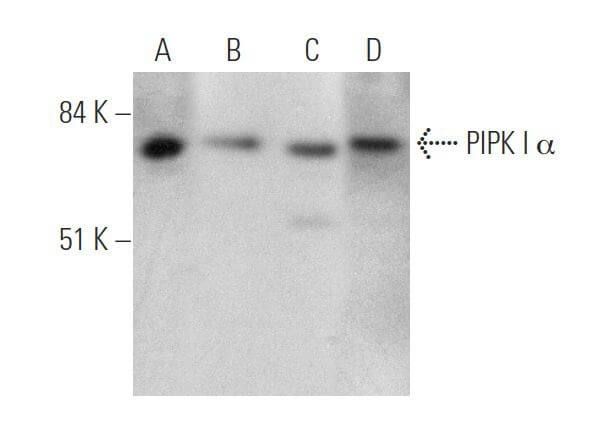 PIPK I α Antibody (D-4) | SCBT - Santa Cruz Biotechnology