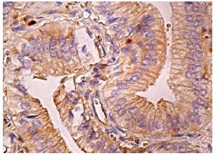 PIPK I Antibody (D-12) | SCBT - Santa Cruz Biotechnology
