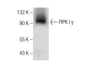 PIPK I γ 항체 (D-7) | SCBT - Santa Cruz Biotechnology