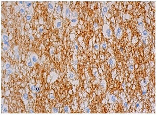 PIPK II Antibody (D-3) | SCBT - Santa Cruz Biotechnology