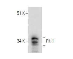 Anti-Pit-1 Antibody (A-1) | SCBT - Santa Cruz Biotechnology