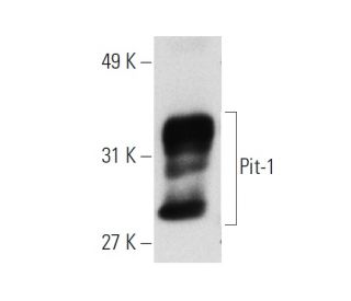 Pit-1 Antibody (X-7) | SCBT - Santa Cruz Biotechnology