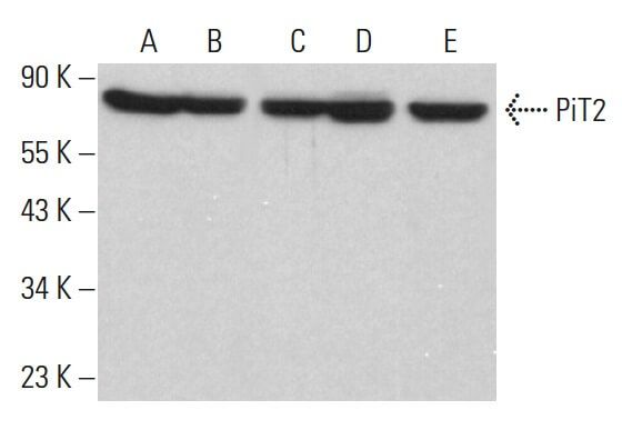 PiT2 Antibody (B-4) | SCBT - Santa Cruz Biotechnology