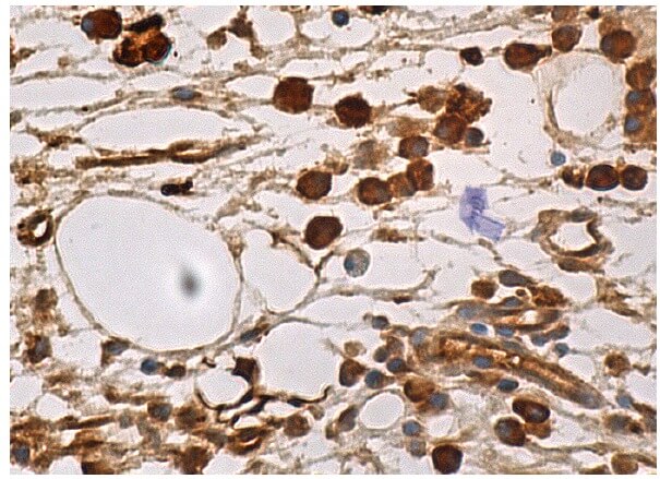 PKA Iα/β reg Antibody (B-6) | SCBT - Santa Cruz Biotechnology PKA Iα/β reg Antibody (B-6) | SCBT - Santa Cruz Biotechnology