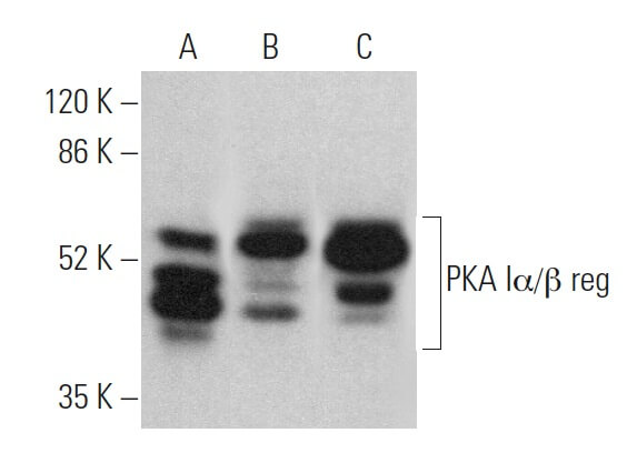 pka-ialpha-beta-reg-antibody-b pka-ialpha-beta-reg-antibody-b