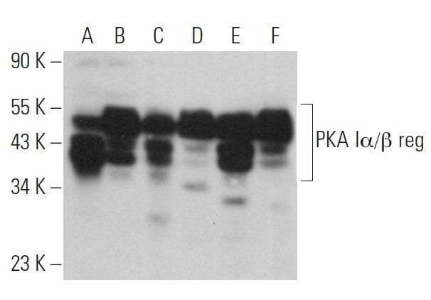 PKA Iα/β reg抗体 (B-6) | SCBT - Santa Cruz Biotechnology