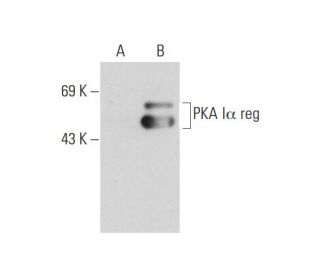 PKA Iα reg Antibody (20) - Western Blotting - Image 129183