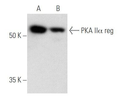 PKA IIα reg抗体 (M-20) | SCBT - Santa Cruz Biotechnology