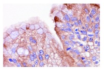 PKC α Antibody (H-7) | SCBT - Santa Cruz Biotechnology